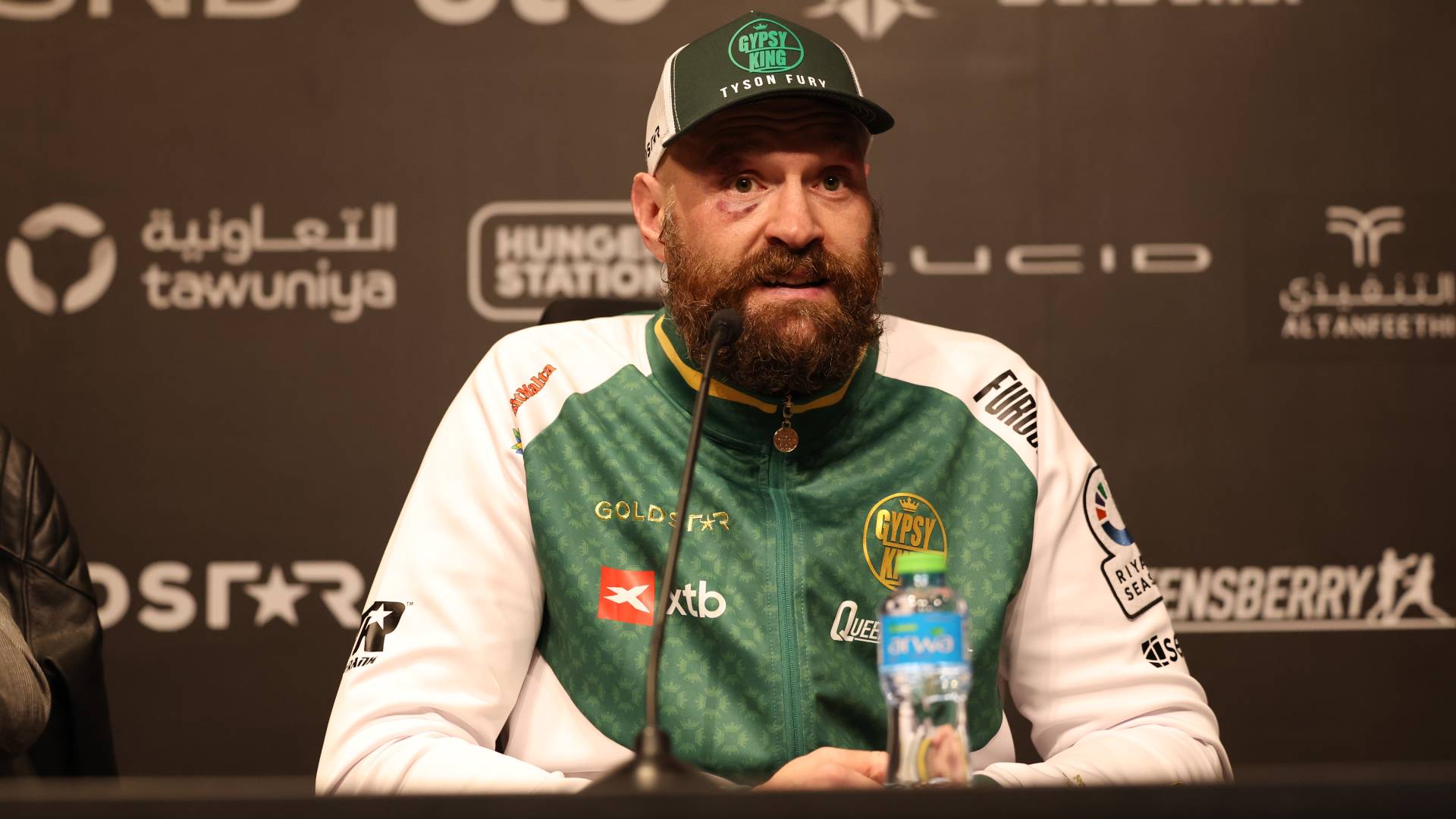 Analysis: How a British world champion can stop Tyson Fury’s comeback ...