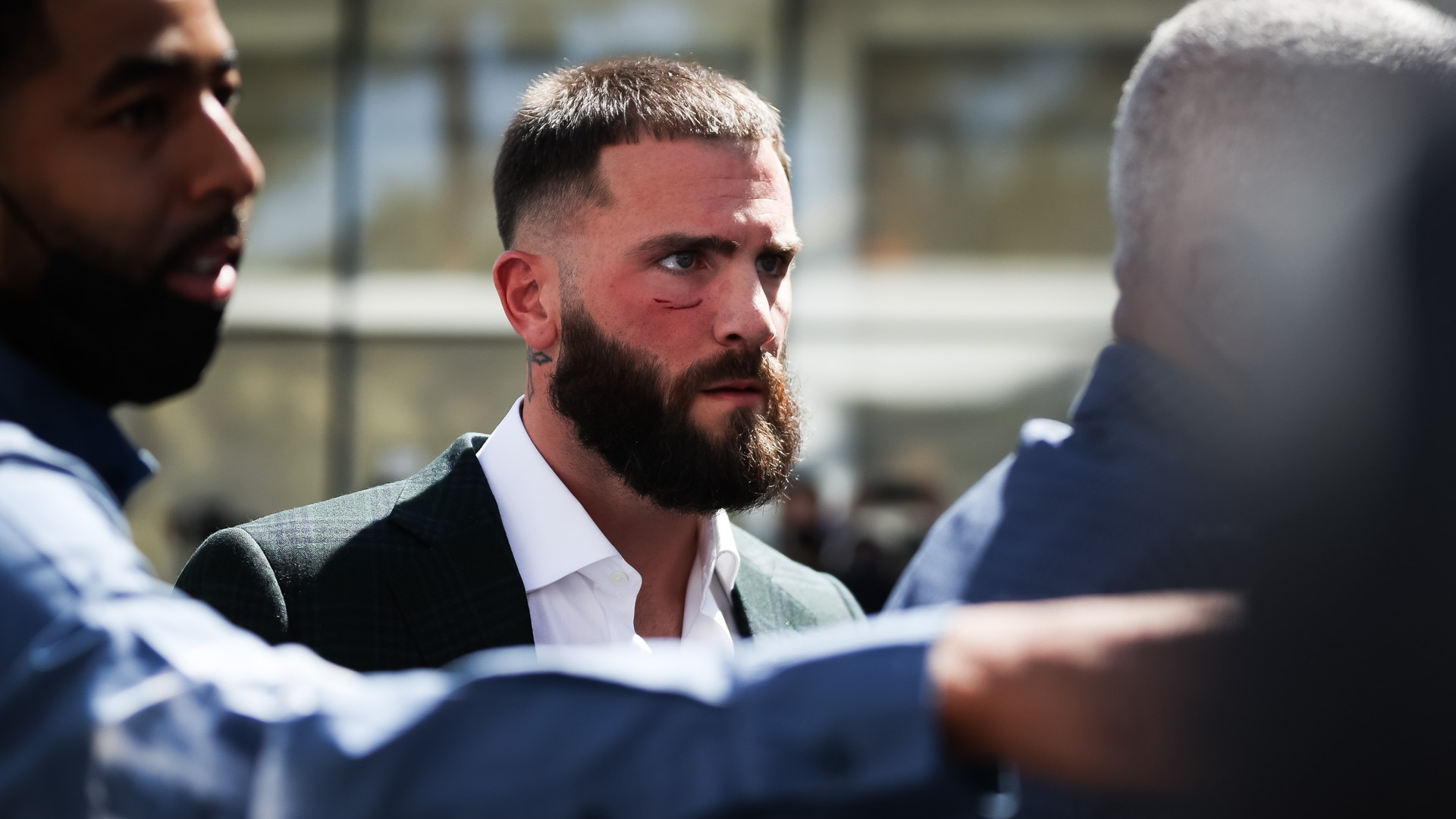 Plant aseguró que el corte en el rostro no será impedimento para ...