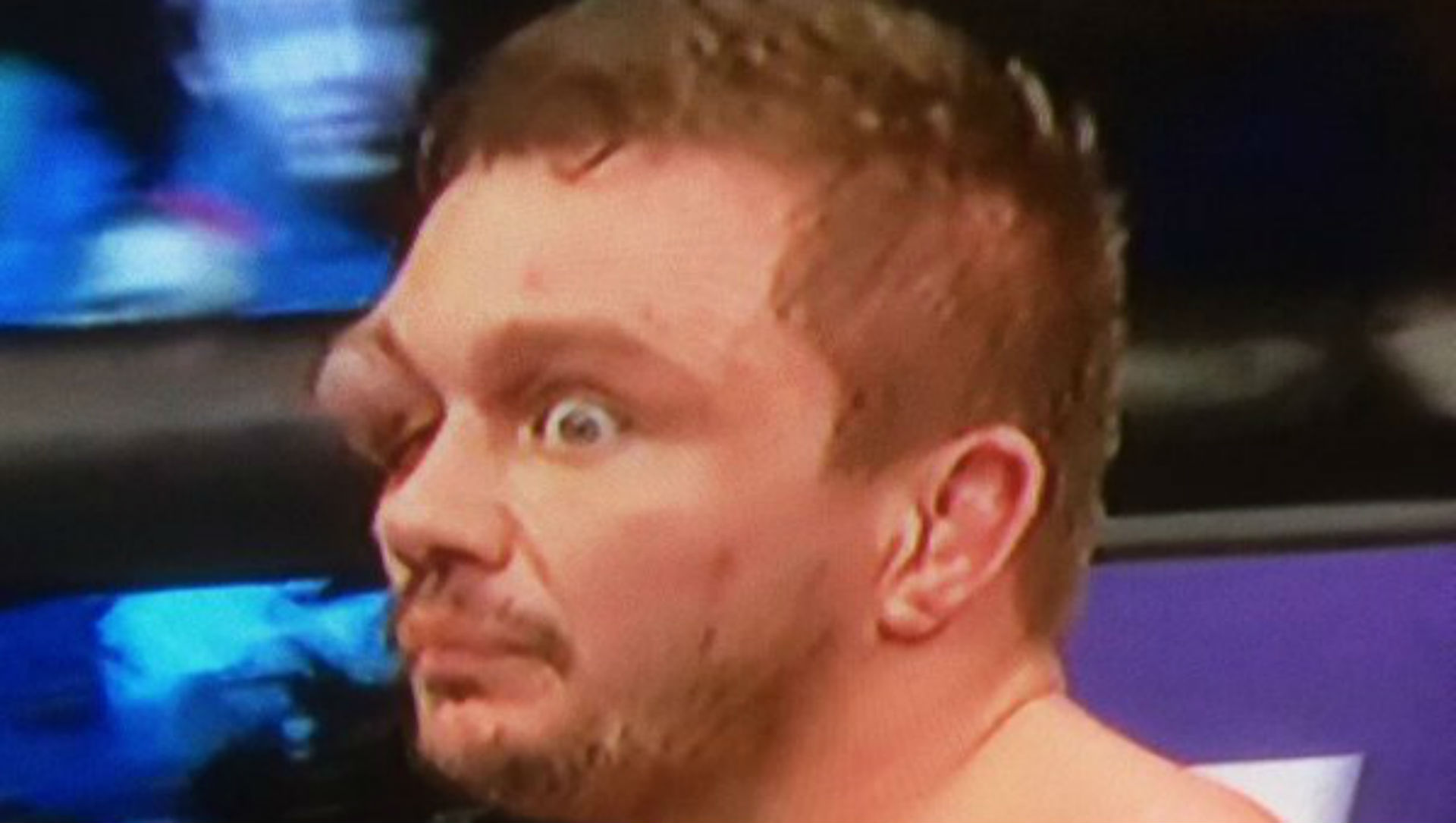 Video: Gruesome eye-injury at UFC in Boston | Sporting News Australia